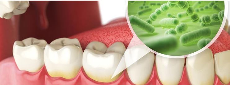 ¿Sabes qué es el periodonto? | Clínica Dental Mozas